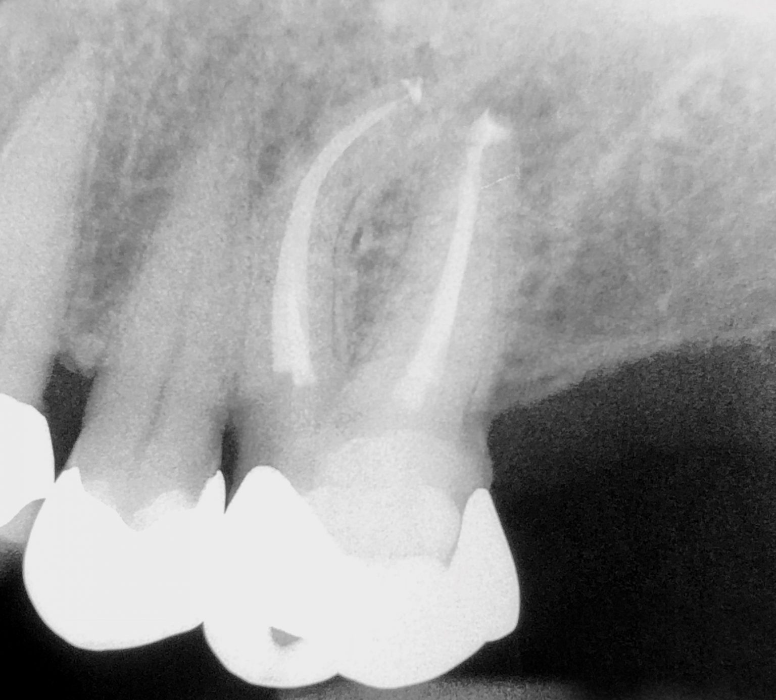 Wurzelkanalbehandlungen - ZAHNARZTPRAXIS GERNER & NOETZEL